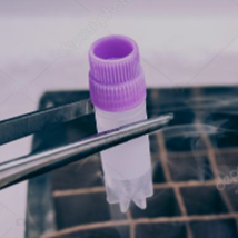 NCC-ASPS1-C1 – World of sarcoma cell line